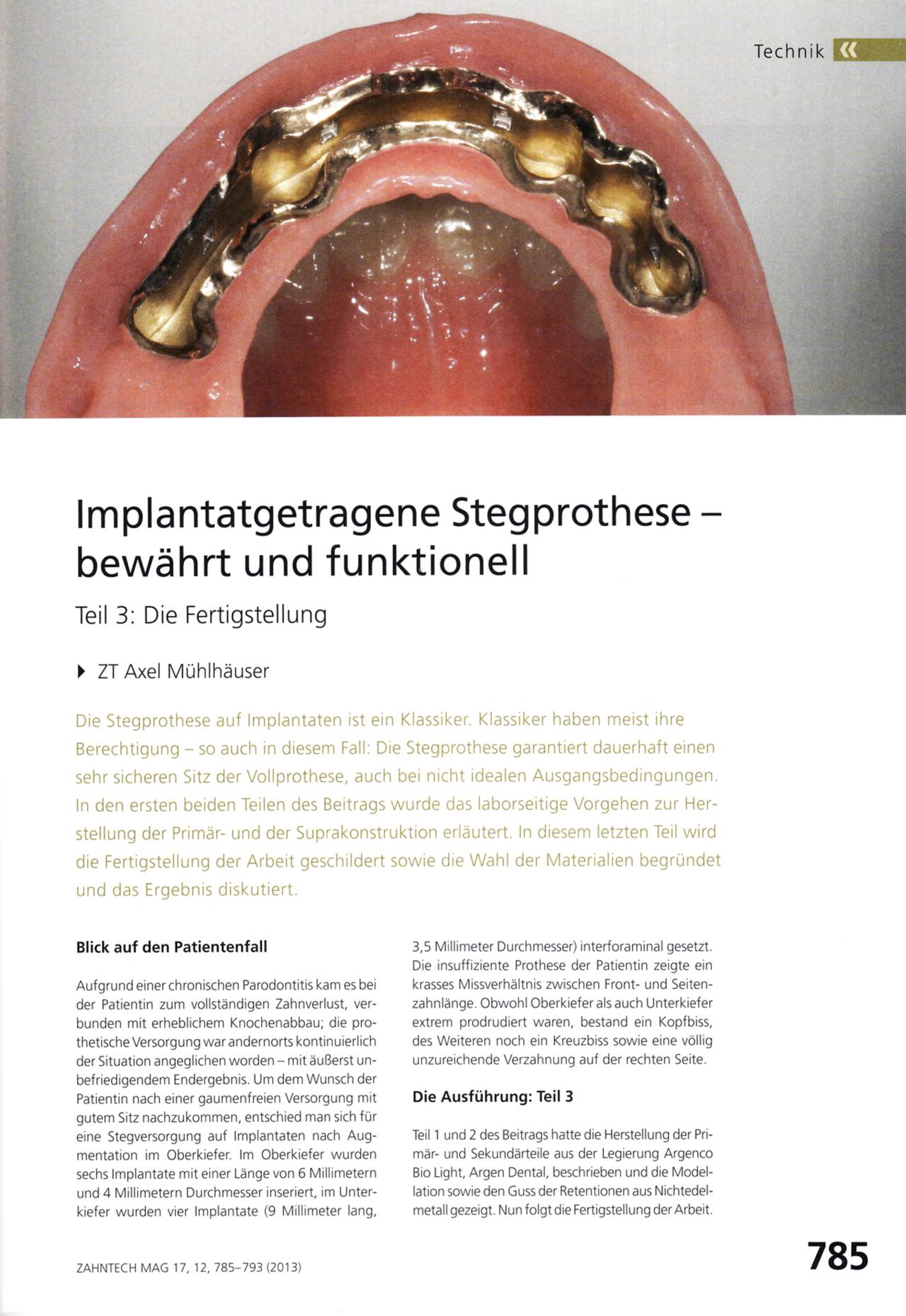 FB | Implantargetragene Stegprothese › Komet Magazin