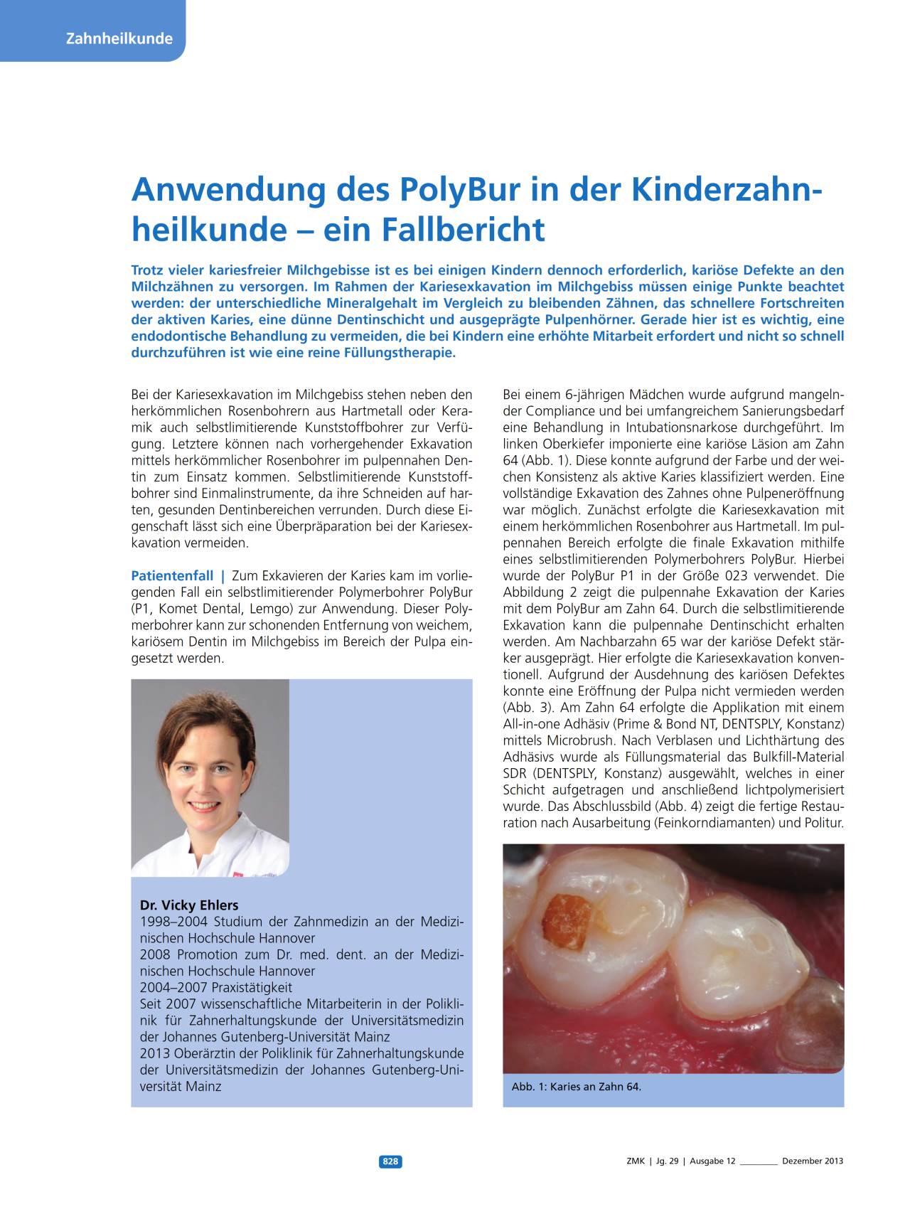 FB | Kronenpräparation: das Parodontium schonen › Komet Magazin