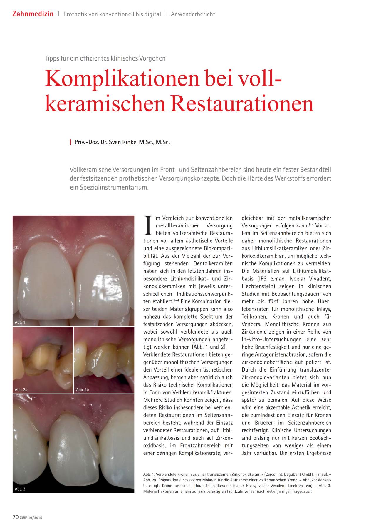 FB | Komplikationen bei vollkeramischen Restaurationen › Komet Magazin