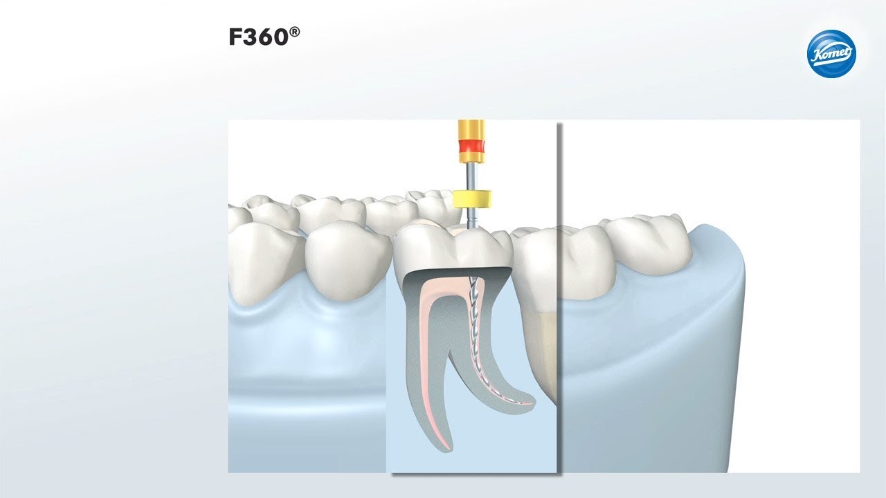 Video | F360® Animation › Komet Magazin